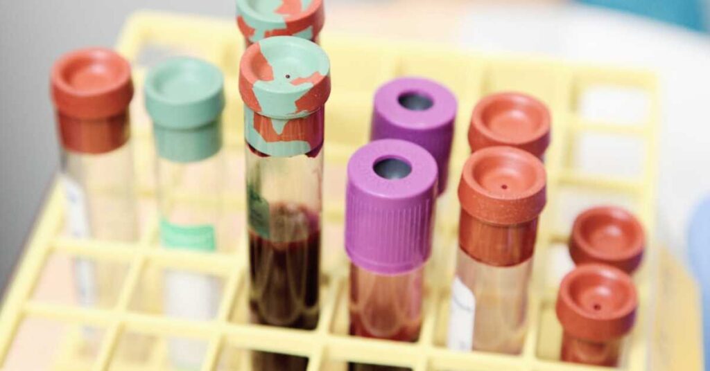 Naturopathic Blood Draws and Injections at Temple Natural Health